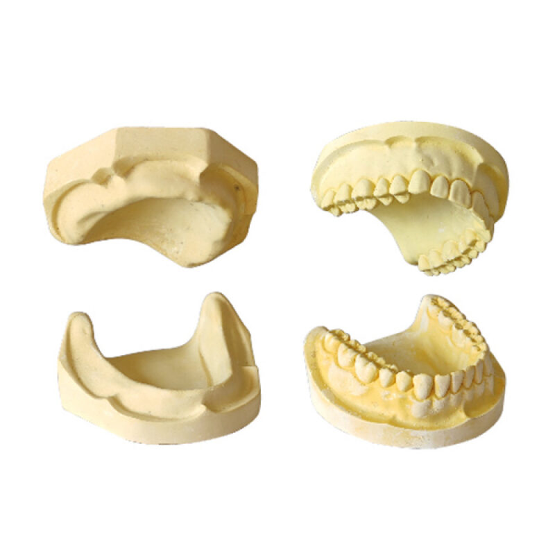 MODELO DE YESO PARA ESTUDIO PAR - Dentosmed