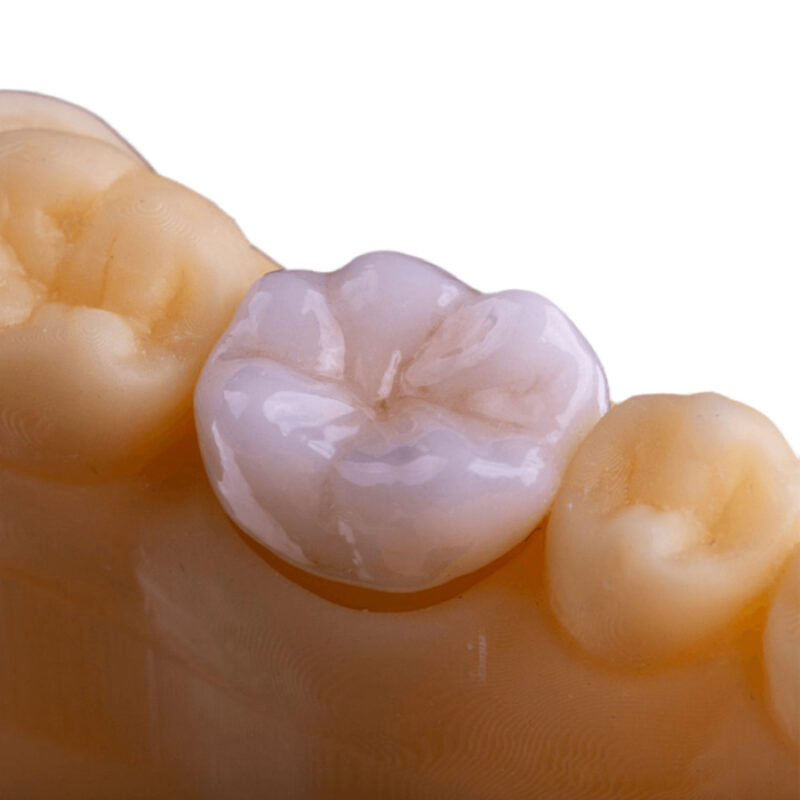 RESINA PARA IMPRESORA 3D BIO CROWN DIAMOND PARA CORONAS DE RESINA ...